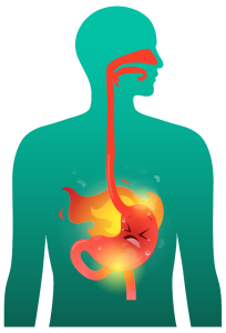 RefluxG® – Fast, Natural Heartburn Relief in Malaysia